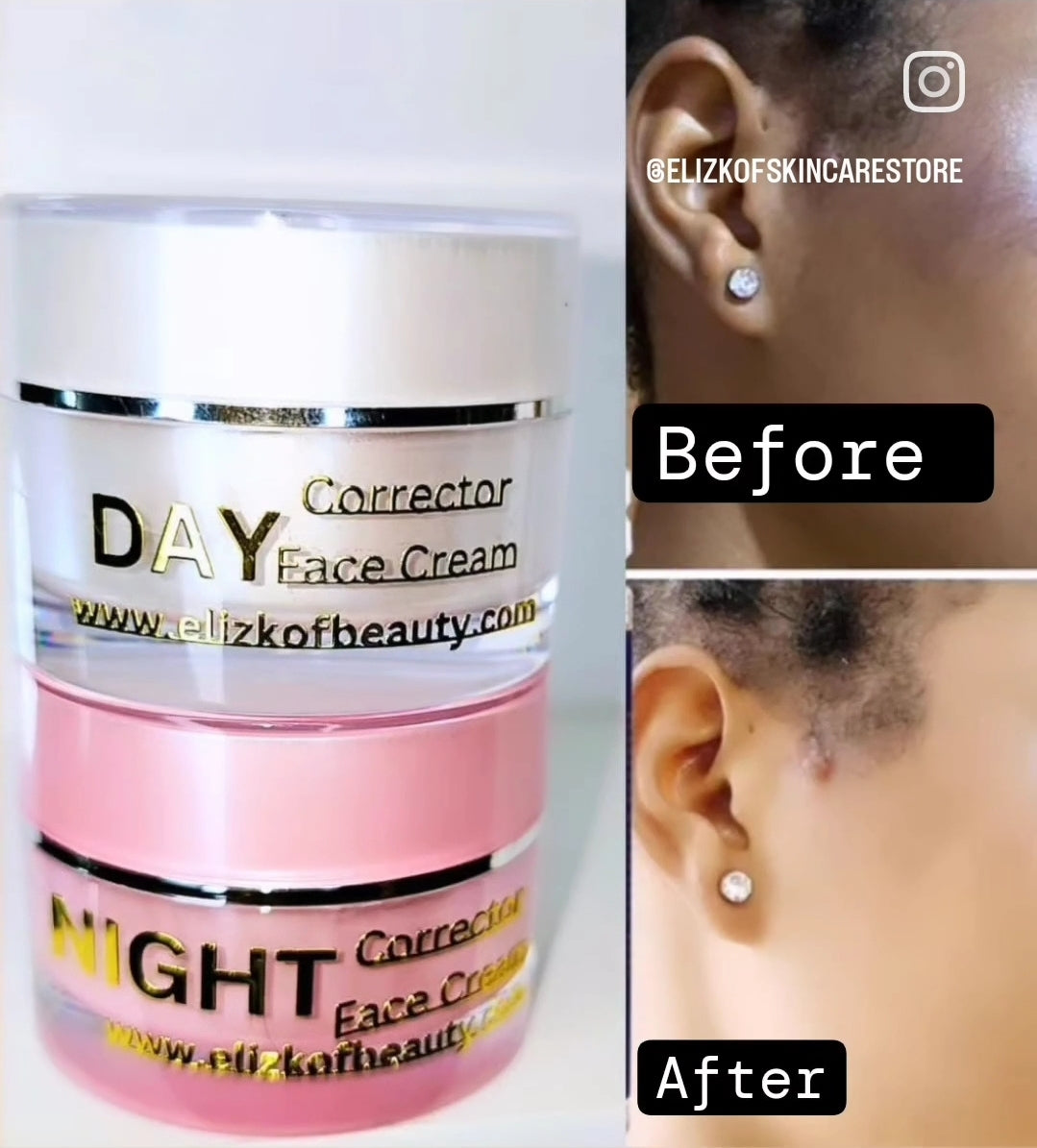 Corrector Face Cream ( 2in1 spot removal cream) 25ml each – elizkofbeauty